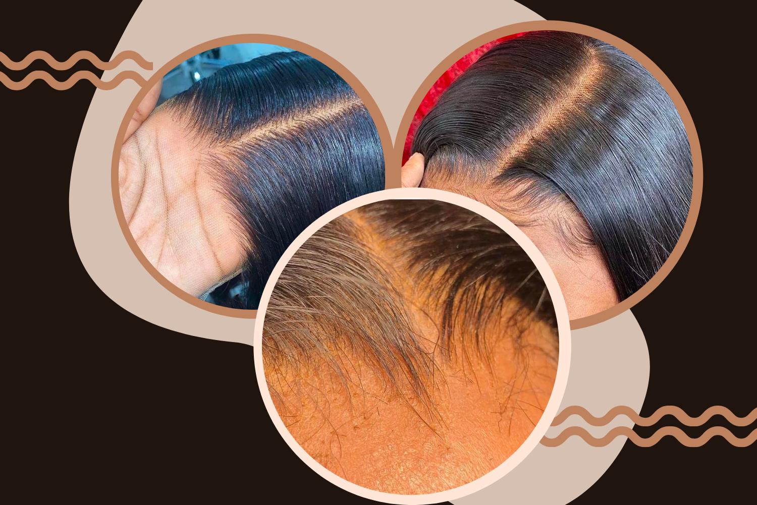 Wig Laces - What Different Types are There?